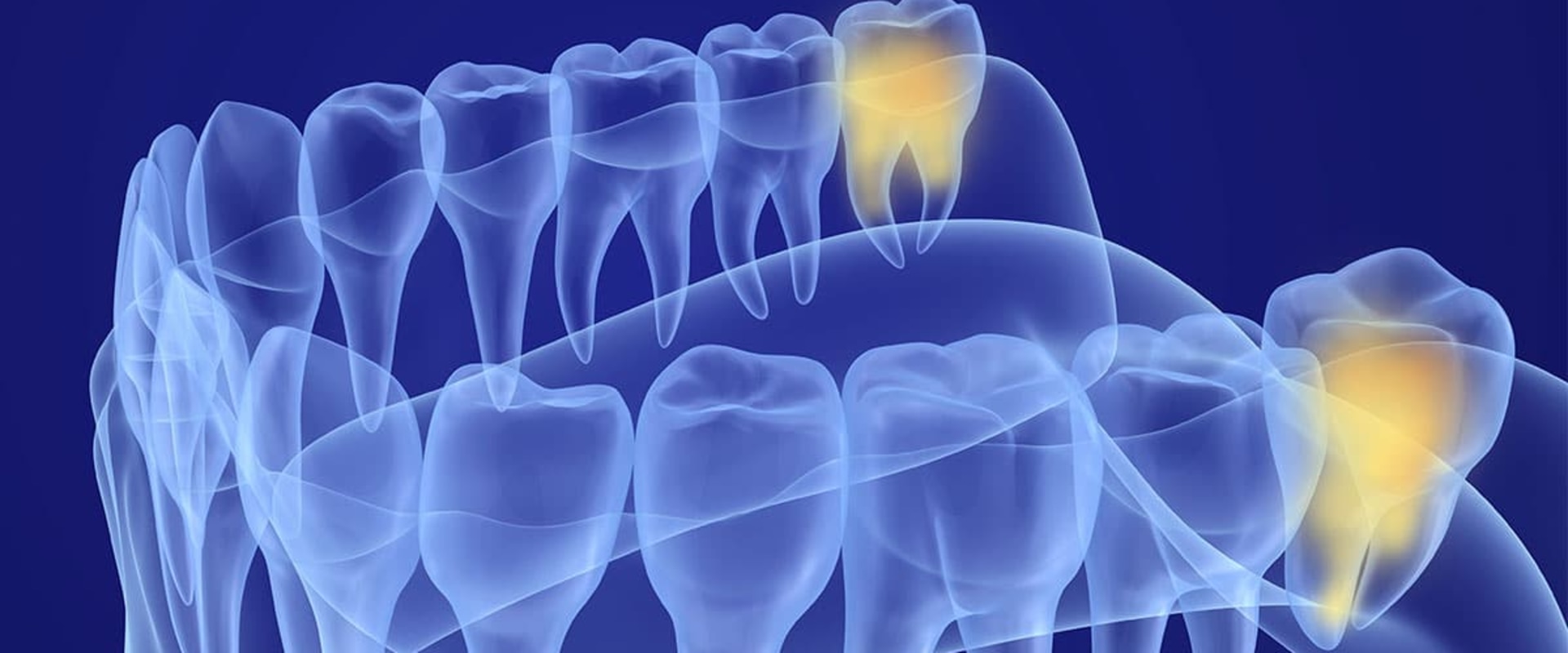 What are the Steps of Tooth Extraction? A Comprehensive Guide